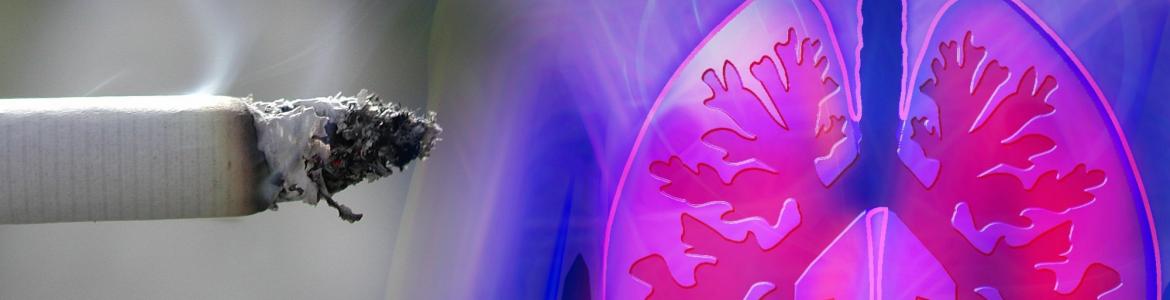 IESP - Tumor maligno de tráquea, bronquios y pulmón | Comunidad de Madrid